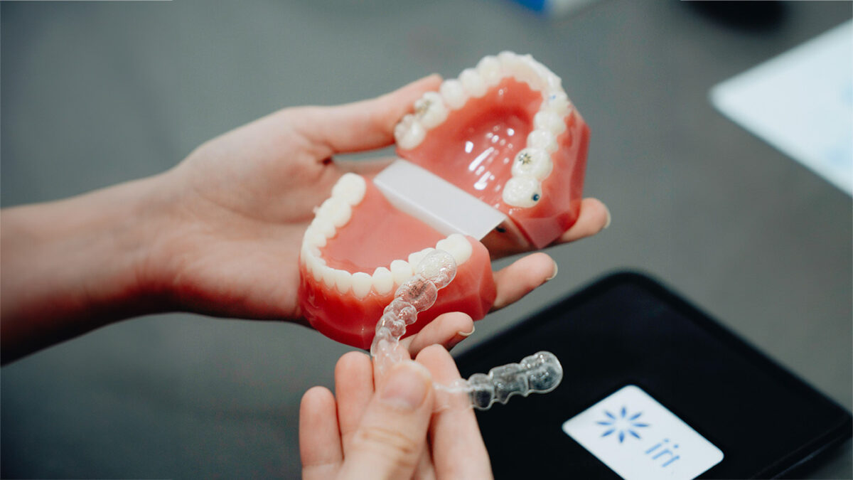 Ease Clear Aligners Discomfort | 6 Pro Tips - Henry Orthodontics